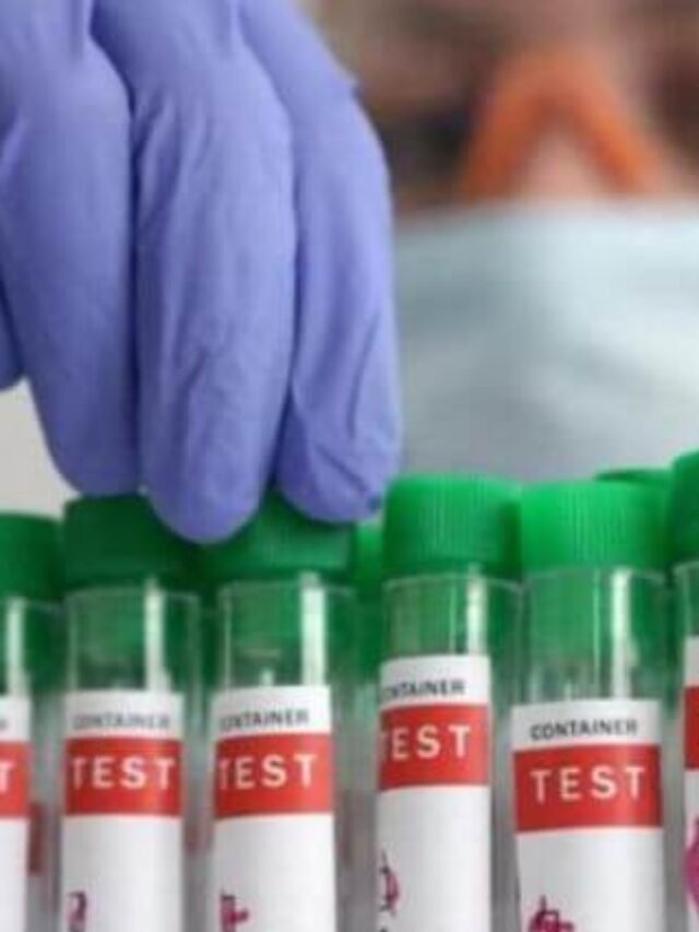 Why HIV Testing is Important - Insights Care